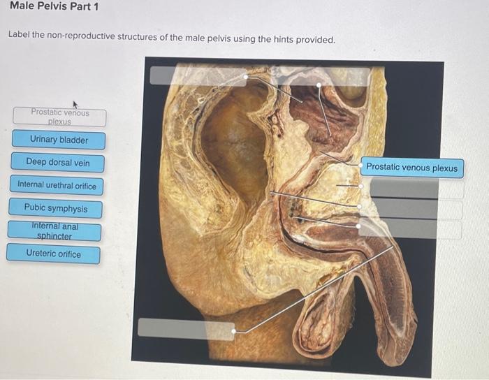 Solved Label The Non Reproductive Structures Of The Male