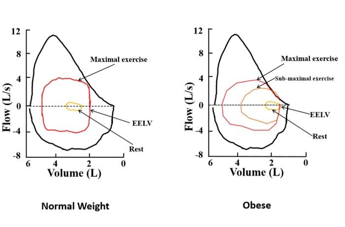 Solved Explain the impact of excess central body fat on | Chegg.com