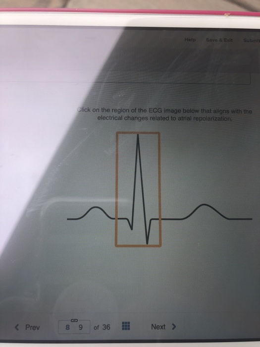 Solved Help Save & Exit Submit Click on the region of the | Chegg.com