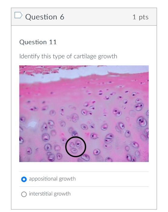 Solved Question 6 Question 11 Identify this type of | Chegg.com