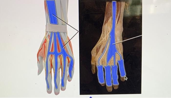 Solved Tendon of extensor digiti minimi Dorsal interossei | Chegg.com
