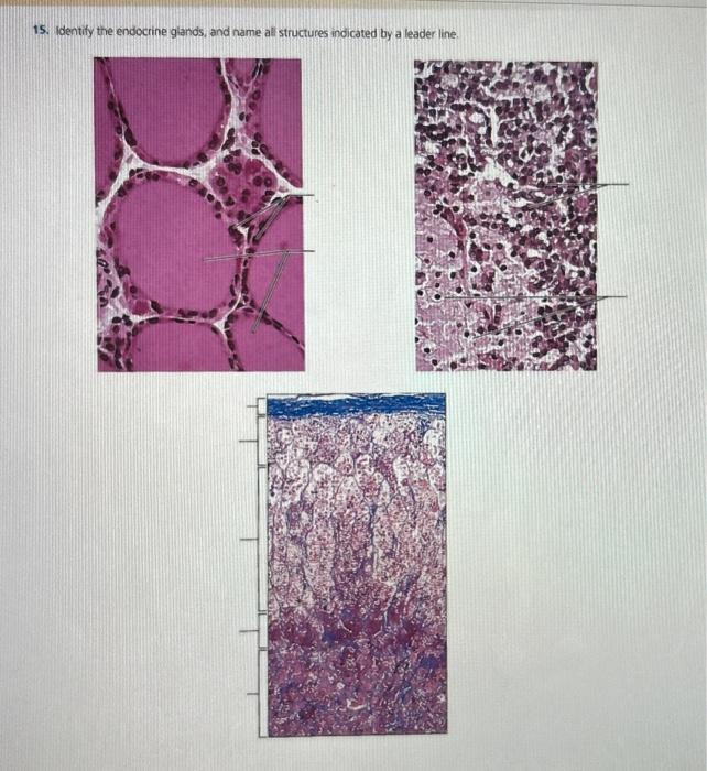 Solved 15. Identify the endocrine glands, and name al | Chegg.com