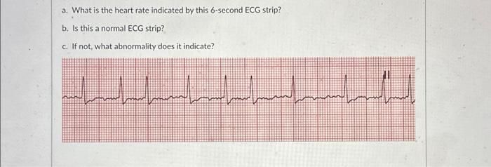 a. What is the heart rate indicated by this 6-second | Chegg.com