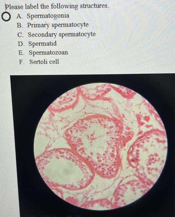 Solved Please label the following structures A. Tunica | Chegg.com