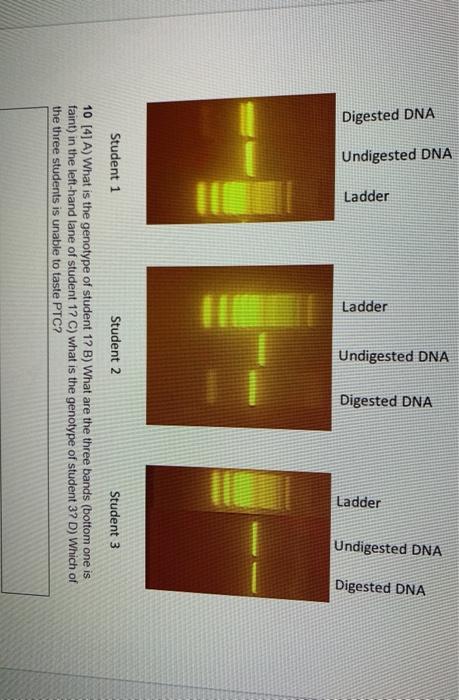 Solved Digested DNA Undigested DNA Undigested DNA Ladder | Chegg.com