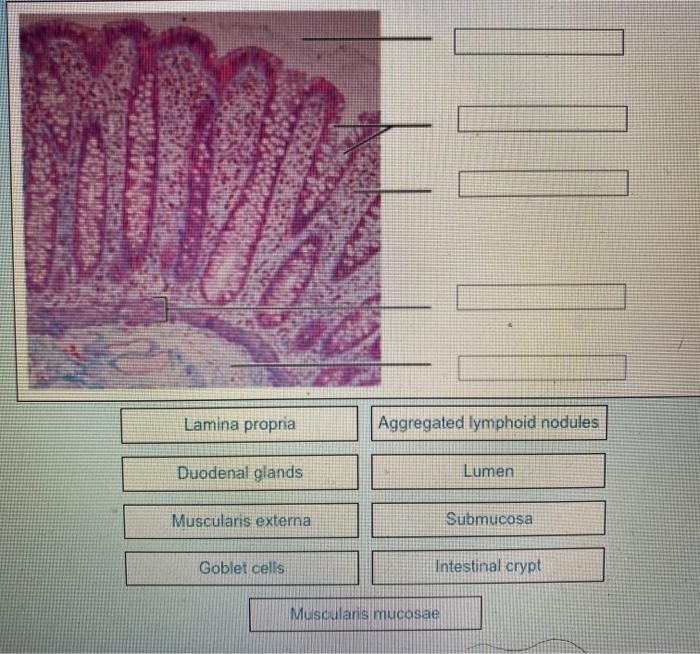 Solved Villus Simple columnar epithelium Lamina propria | Chegg.com
