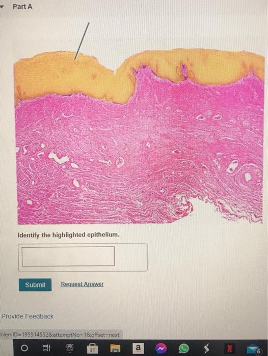 Solved v Part A Identify the highlighted structure. Bones | Chegg.com