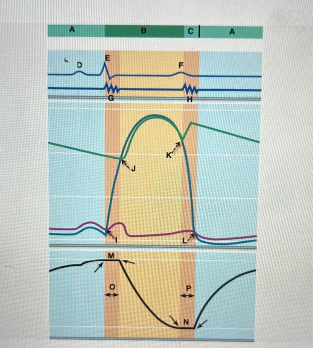 Solved ECG wave T: Ventricular repolarization Semilunar | Chegg.com