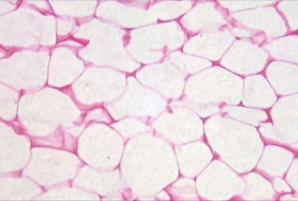 Solved How to tell whether this tissue epithelial, | Chegg.com