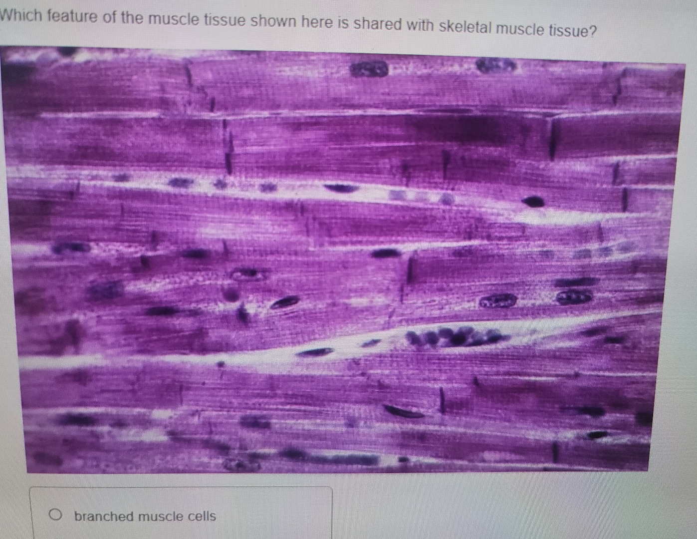 Solved Which feature of the muscle tissue shown here is | Chegg.com
