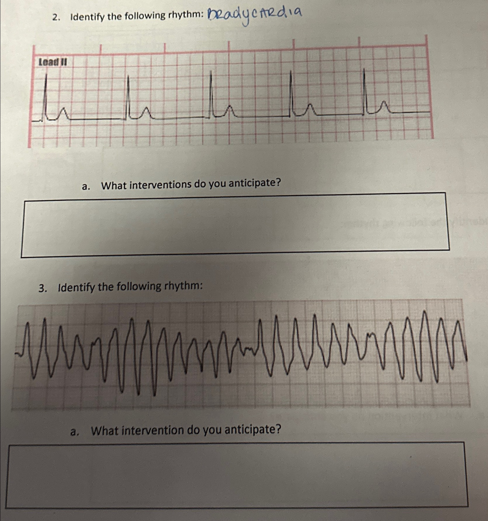 Identify the following rhytHma. ﻿What interventions | Chegg.com