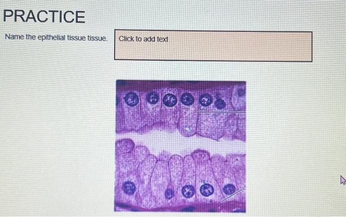 Solved Name the epithelial tissue tissue. PRACTICE Name | Chegg.com