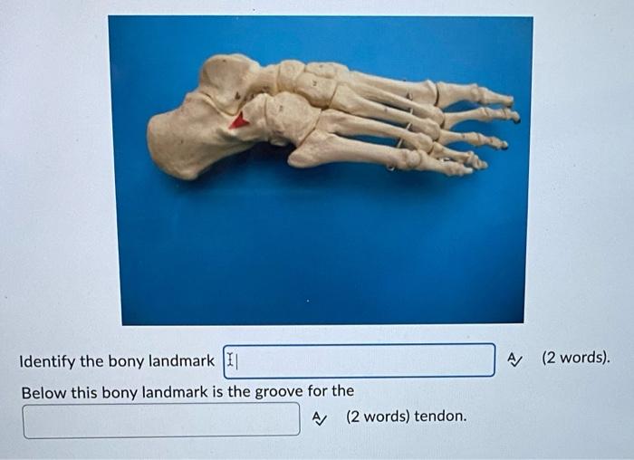 Solved This bony landmark is called the A of the A (number | Chegg.com