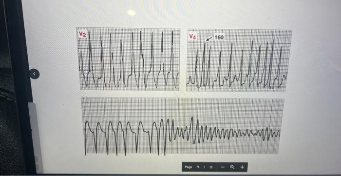 Solved identify the QRS, QT, heart rate and PR, ST, and | Chegg.com