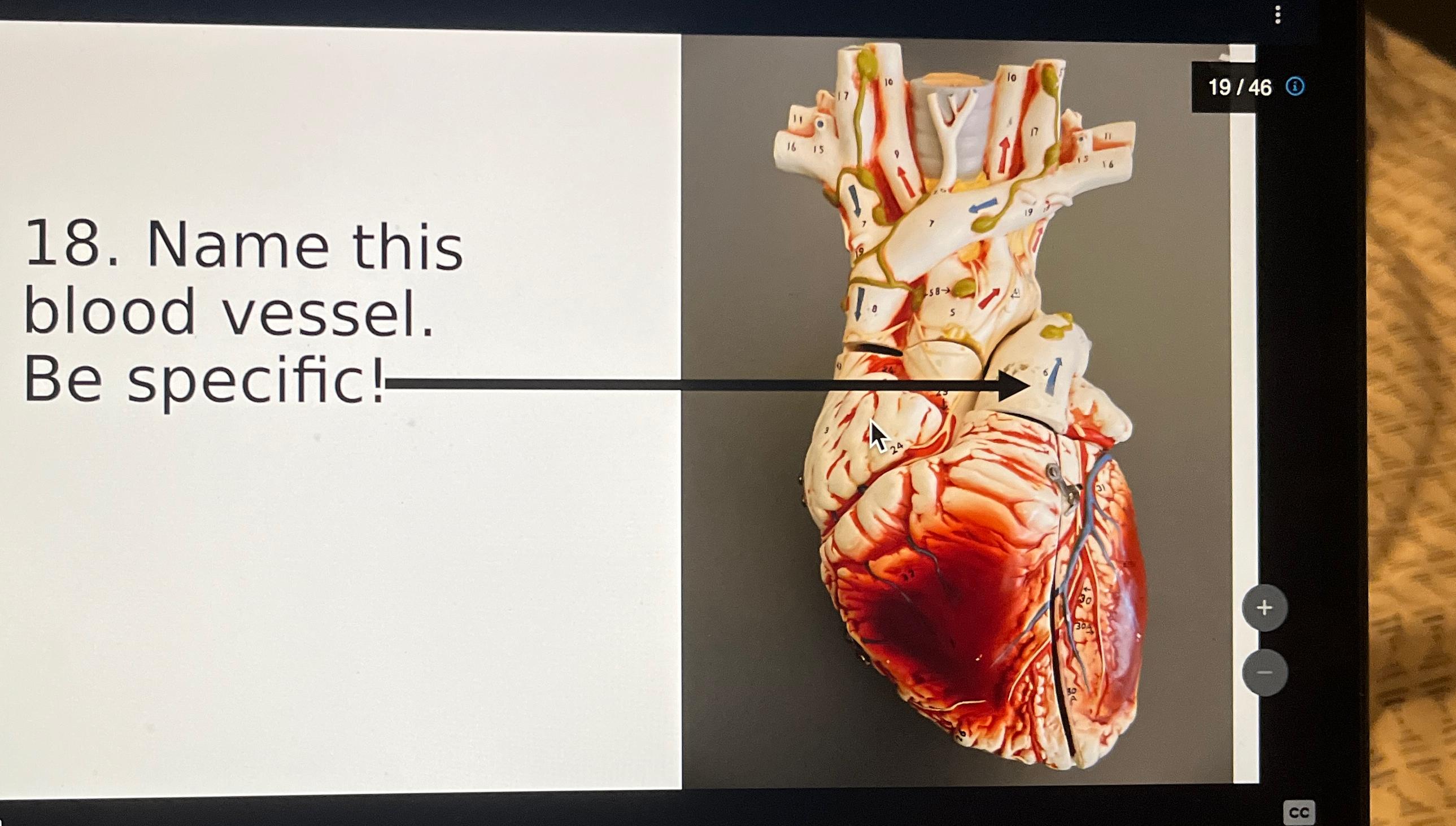 Solved Name this blood vessel. Be specific! | Chegg.com