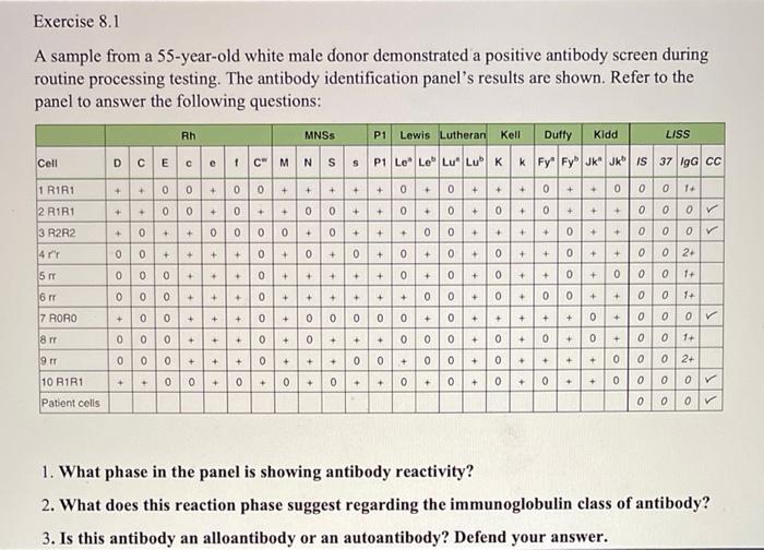 Solved Ah Kidd Cell D 1 R1R1 + Exercise 8.1 A sample from a | Chegg.com