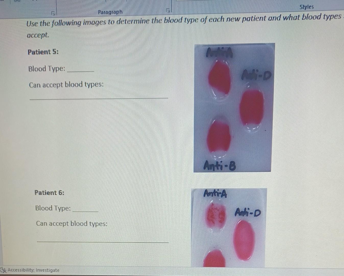Solved Use the following results to determine the blood type | Chegg.com