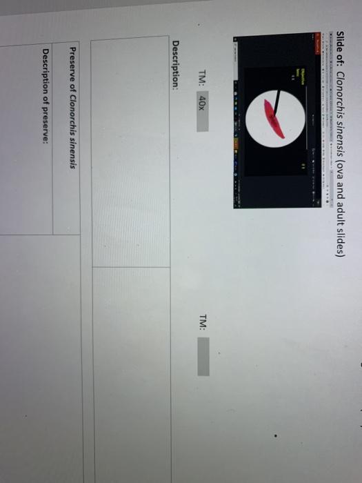 Solved Slide of: Clonorchis sinensis (ova and adult slides) | Chegg.com