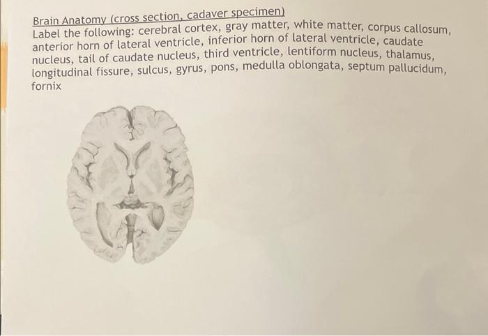 Brain Anatomy (cross section, cadaver specimen) Label | Chegg.com