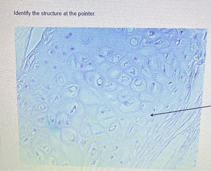 Solved Identify the structure at the pointer. | Chegg.com