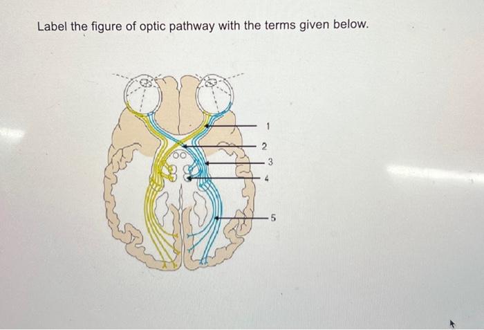 Solved Label the figure of optic pathway with the terms | Chegg.com