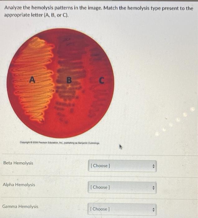 Solved Analyze the hemolysis patterns in the image. Match | Chegg.com