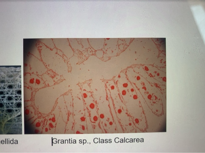 Solved im having a hard time labeling this slide of grantia. | Chegg.com