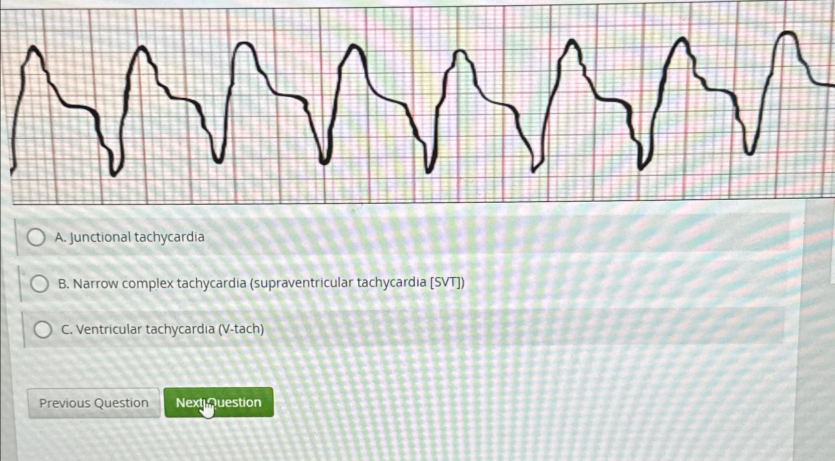 Solved A. ﻿Junctional tachycardiaB. ﻿Narrow complex | Chegg.com