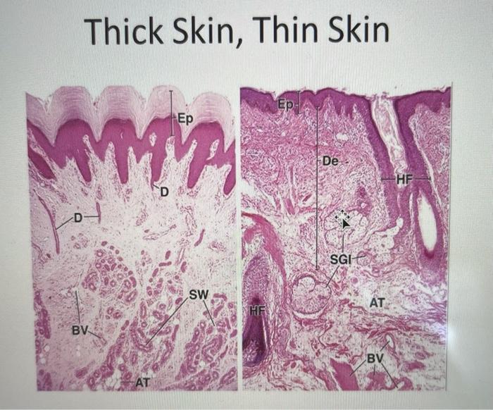 Solved 1. Observe the palmar skin (thick skin) pictures | Chegg.com