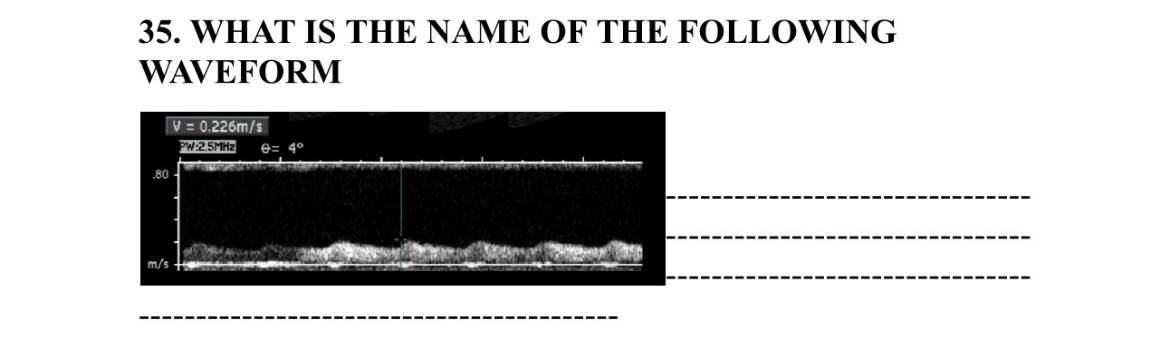 Solved WHAT IS THE NAME OF THE FOLLOWING WAVEFORM | Chegg.com