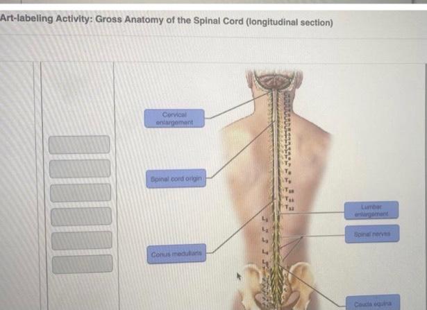 Solved The Roots and Branches of a Spinal Nerve Dorsal root | Chegg.com
