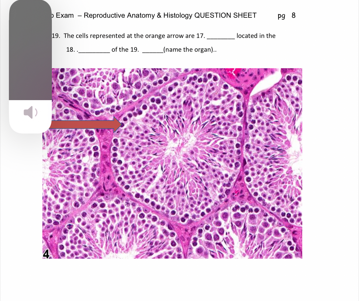 Solved Exam - ﻿Reproductive Anatomy & Histology QUESTION | Chegg.com