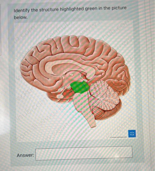 Solved Identify the structure highlighted green in the | Chegg.com