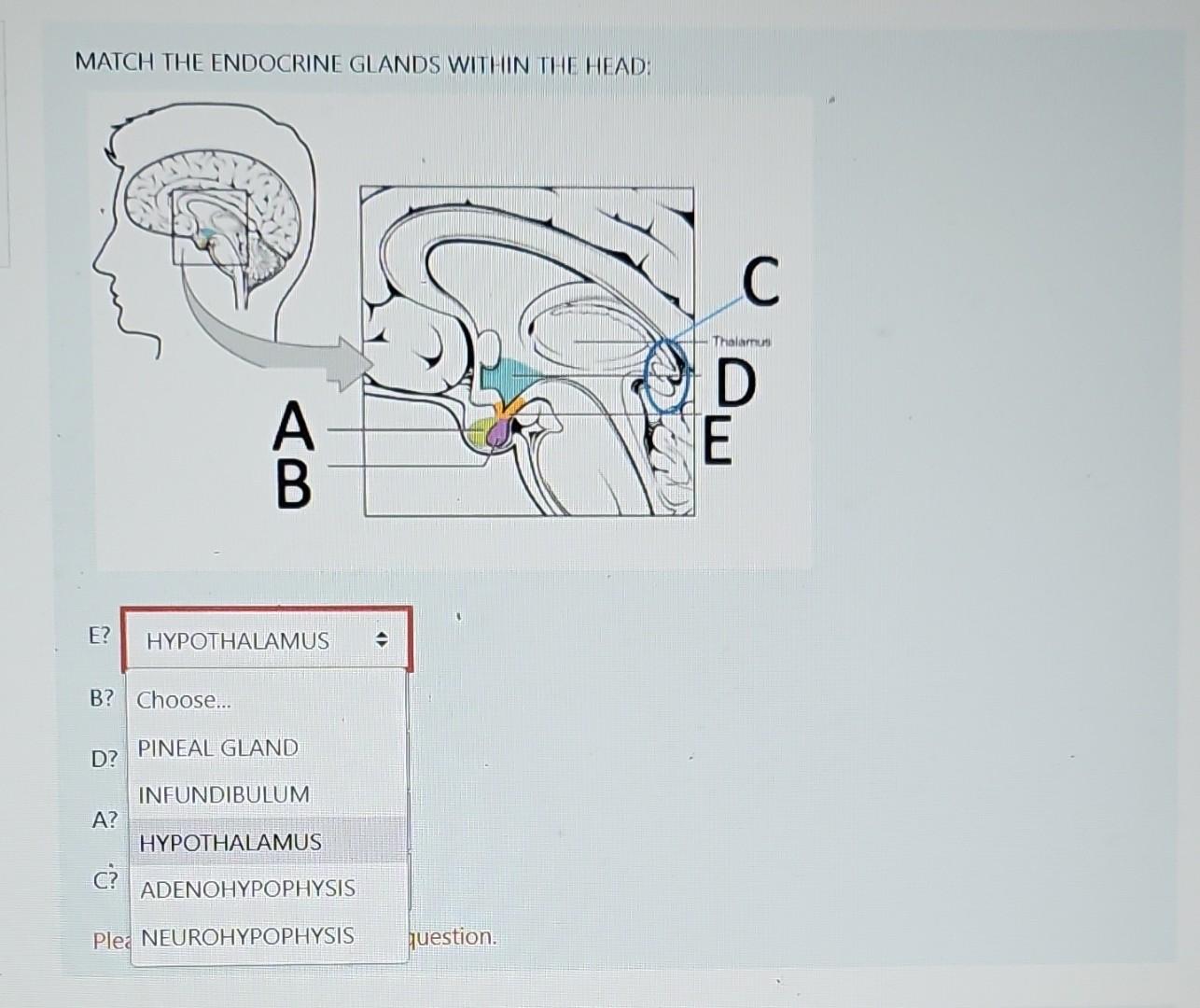 Solved MATCH THE ENDOCRINE GLANDS WITHIN THE HEAD: | Chegg.com