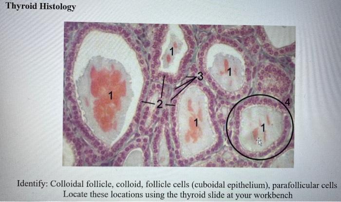 Solved Thyroid Histology Identify: Colloidal follicle, | Chegg.com