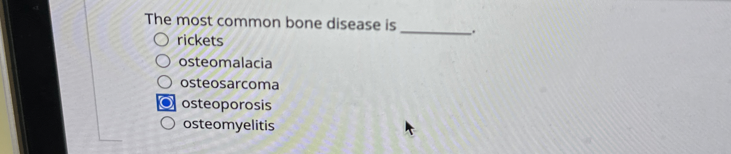 Solved The most common bone disease | Chegg.com
