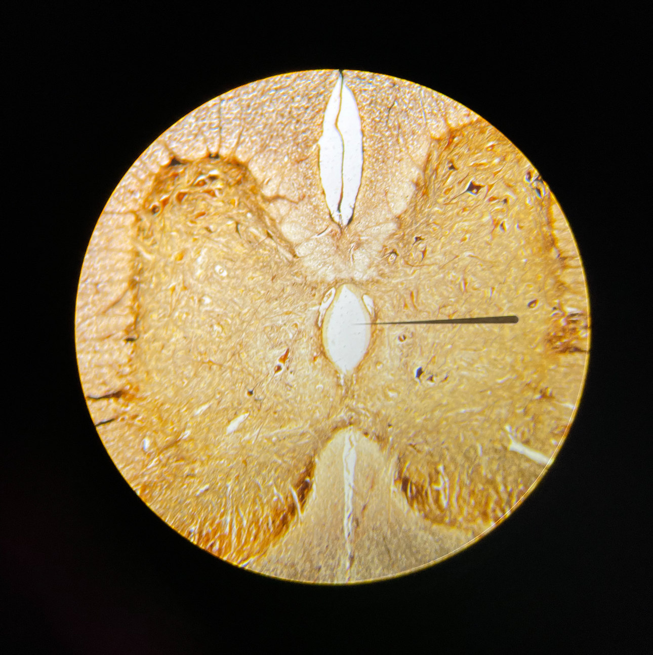 Label the Neurin Structures: Axon, Dendrites, abd | Chegg.com