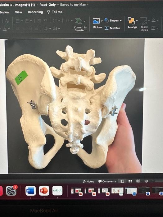 Solved DEM Bones: Forensic Resurrection of a Skeleton | Chegg.com