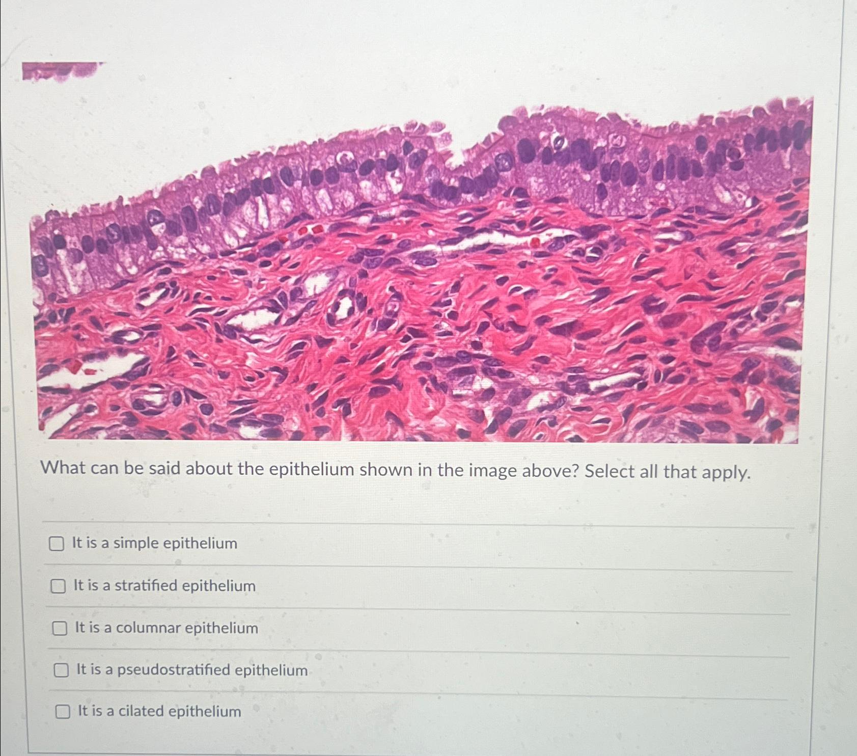 Solved What can be said about the epithelium shown in the | Chegg.com