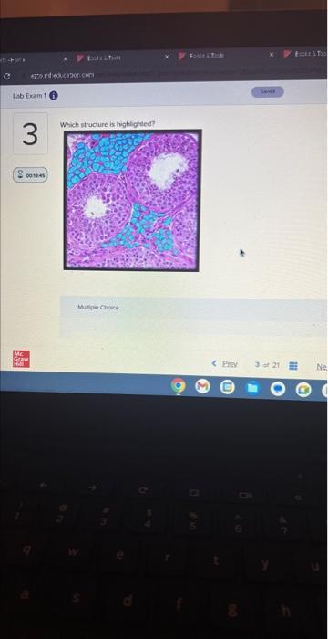 Solved Label the histology of the ovary using the hints | Chegg.com