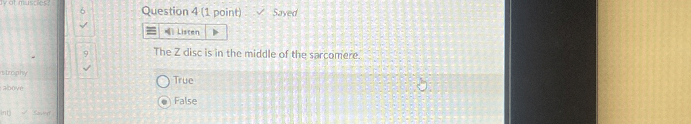 Solved Question 4 (1 ﻿point) ﻿SavedThe Z ﻿disc is in the | Chegg.com