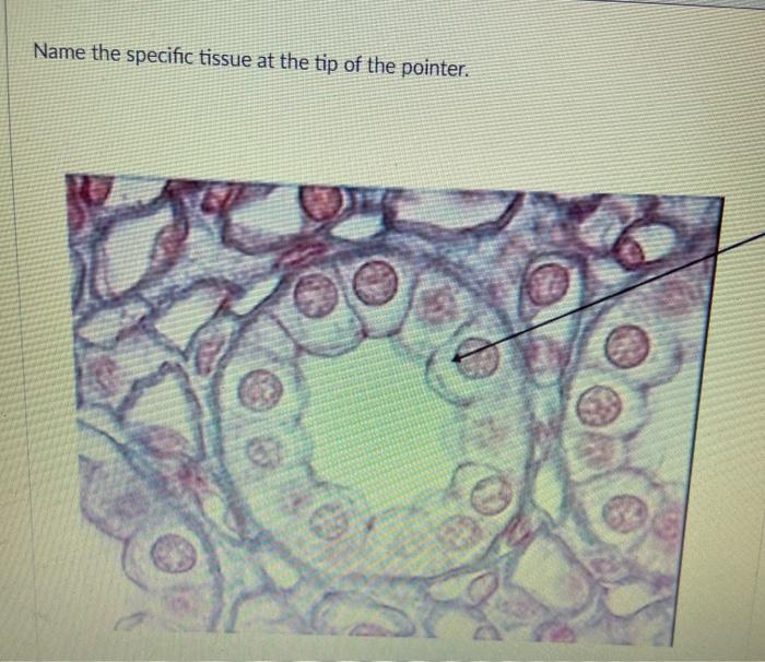 Solved Name the specific tissue at the tip of the pointer. | Chegg.com