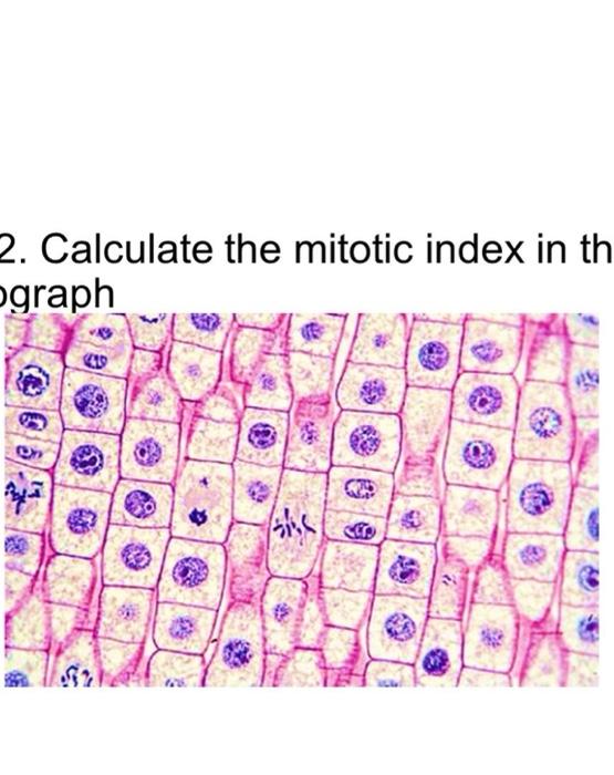 Solved 2. Calculate the mitotic index in th ograph Alis | Chegg.com