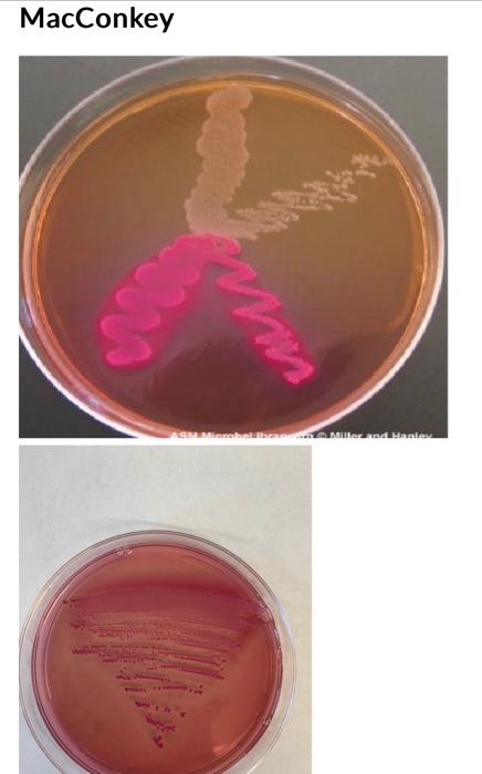 EXERCISE 14: BLOOD AGAR PLATE(BAP) Complete the table | Chegg.com