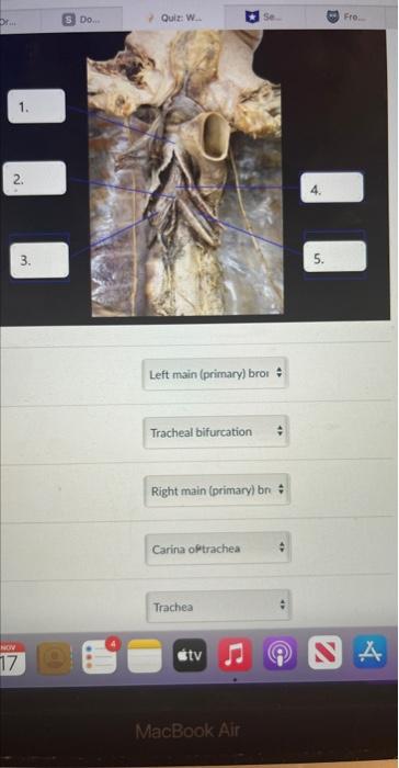 Solved need labeled correctly 1-5 | Chegg.com