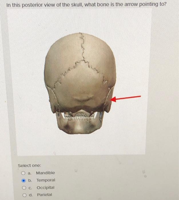 Solved In the lateral view of the skull, what bony landmark | Chegg.com