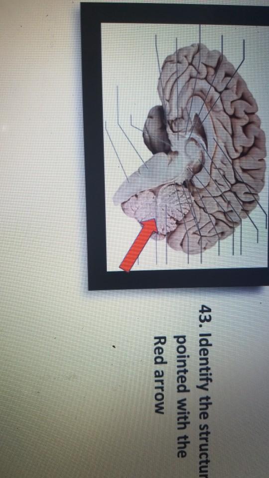 Solved 25 8 41. Identify the structure pointed with the | Chegg.com