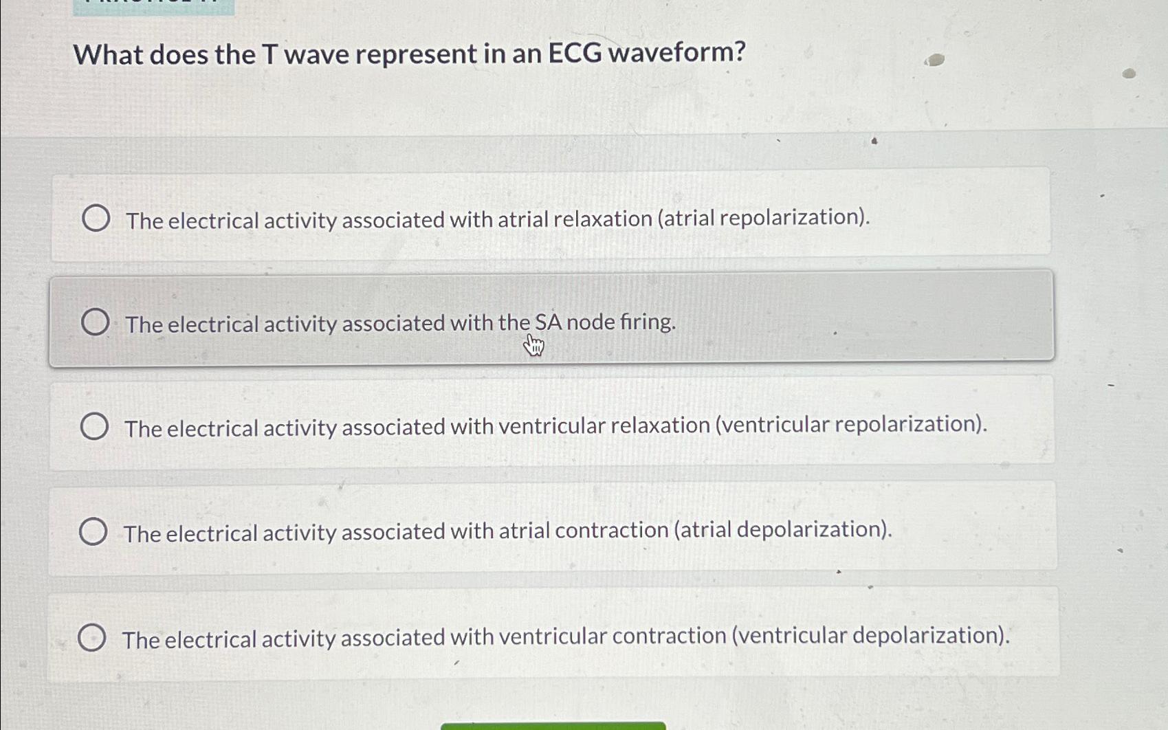 Solved What does the T wave represent in an ECG waveform?The | Chegg.com