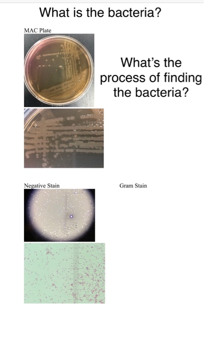 Solved What is the bacteria? MAC Plate What's the process of | Chegg.com