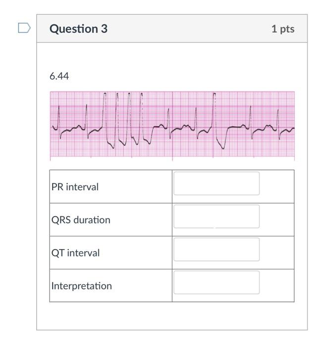 Solved please help calculate the PR interval, QRS duration | Chegg.com